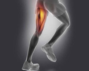 » Distensão muscular: Quais são os sintomas? Tem tratamento? O que fazer?